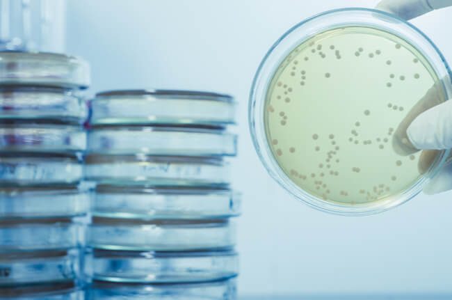 What Is A Legionella Testing Kit? | Legionella Testing | uRisk